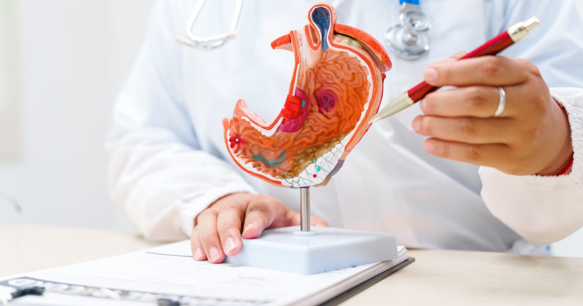 Seeing vs. Measuring: The Roles of Endoscopy & Anorectal… | Medspira